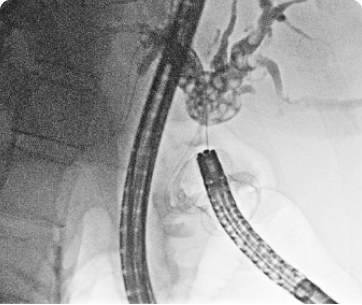 WEEK 3 Case study - Antrang Hospital - Comprehensive GI Superspecialty ...